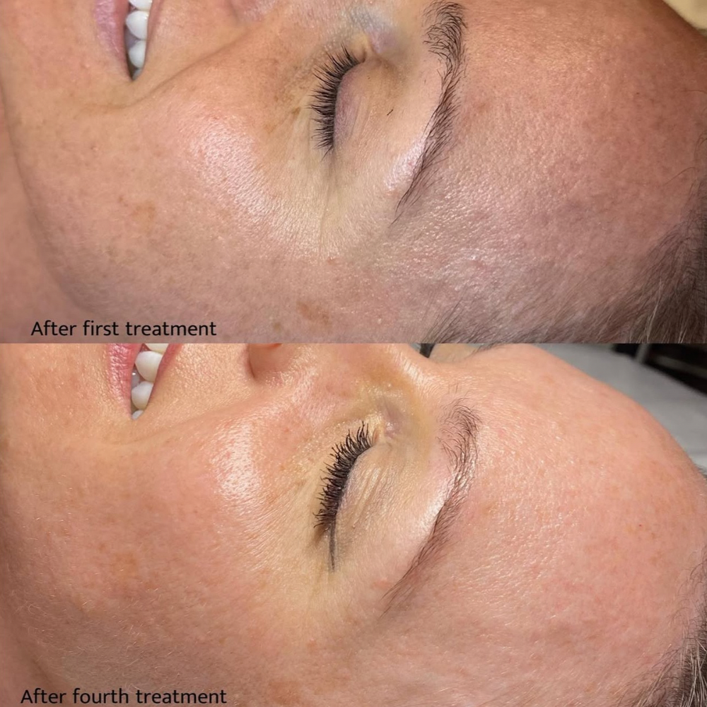 Book Now | Pure Skin + Wellness Spa | Mount Vernon, WA | Pure Skin ...