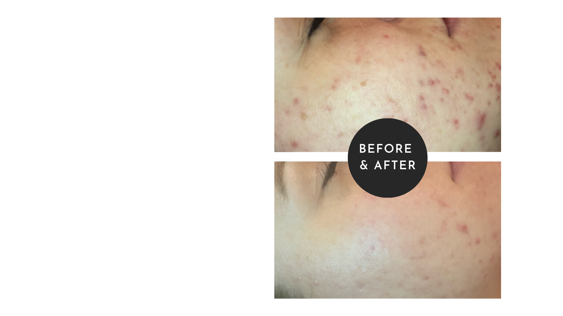 Pure Skin + Wellness Spa | Mount Vernon, WA