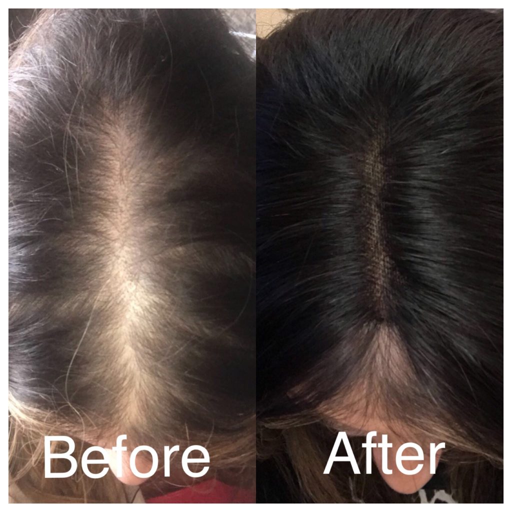 Plated Skin Science Hair Serum | Pure Skin Wellness Spa